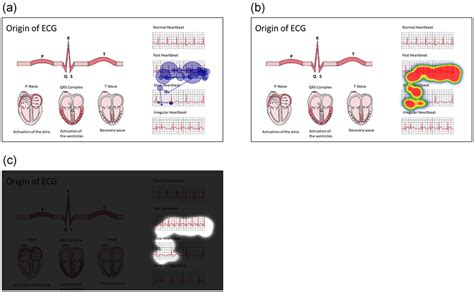 Example Gaze Visualizations A Scanpath B Heatmap And C Focus