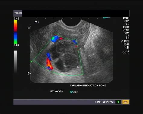 A Gallery Of High Resolution Ultrasound Color Doppler And 3d Images