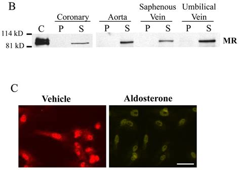 Functional Mineralocorticoid Receptors In Human Vascular Endothelial