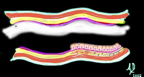 Polyps Colon The Common Vein