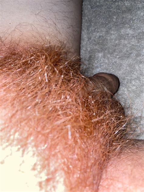 Hairy Ginger Cock 15 Pics Xhamster