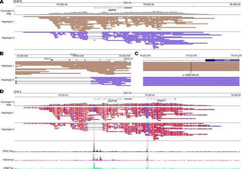 Jci Insight Targeted Long Read Sequencing Enriches Disease Relevant
