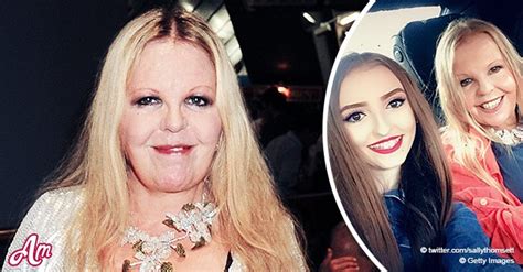 Sally Thomsett Illness What Happened To Her Plastic Surgery Face