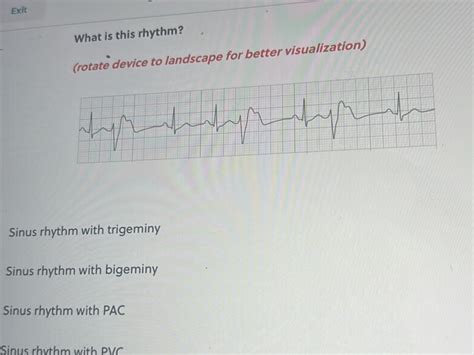 What Is This Rhythm Sinus Rhythm With Studyx What Is This Rhythm Sinus Rhythm With Studyx