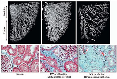 Representative Three Dimensional Reconstruction Of The Renal