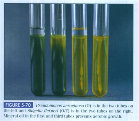 5 2 Oxidation Fermentation Test Flashcards Quizlet