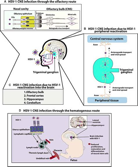 Trigeminal Ganglion Herpes