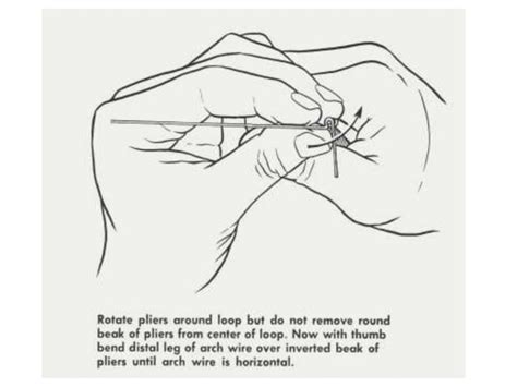Loops In Orthodontics T Loop Bull Loop Vertical Loop Mushroom Loop Stop