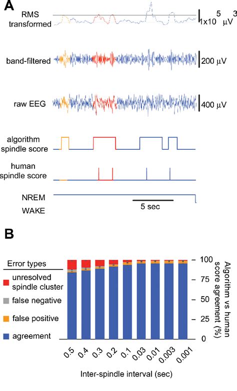 Figure 2 From Validation Of An Automated Sleep Spindle Detection Method