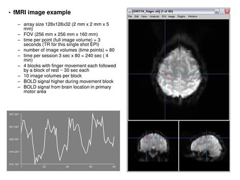 PPT Statistical Parametric Mapping PowerPoint Presentation Free Download ID