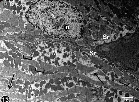 An Electron Micrograph Of Two Cardiac Myocytes From Group Iii Showing Download Scientific