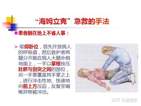 海姆立克急救法 简单实用 知乎