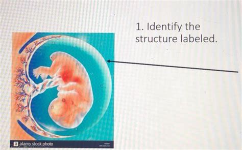 Solved Identify The Structure Labeled Chegg Com
