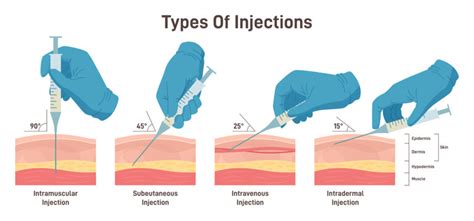 Intravenous Injection Sites
