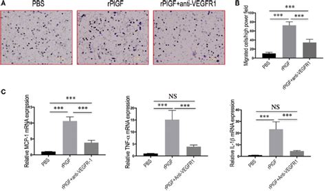 Placental Growth Factor Plgf Promotes Hepatic Macrophage