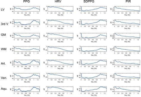 Temporal Average Of Cross‐spectrograms In Various Rois The