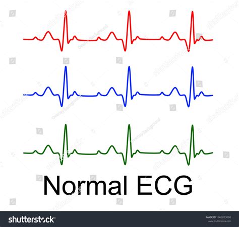 Normal Ecg Vector Analysis Wave Stock Vector Royalty Free 1666823068