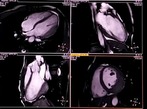 Luiza Fernanda Morgado Posted On Linkedin