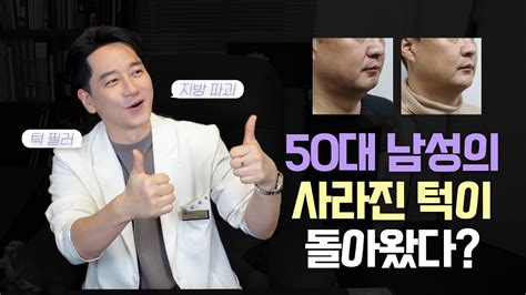 사라진 무턱 이중턱 피부과 시술로 만들 수 있을까 ㅣ 턱 필러 지방파괴 지방분해 주사 윤곽주사 호두주름 보톡스 ㅣ 청담동 금손 김원장 Youtube