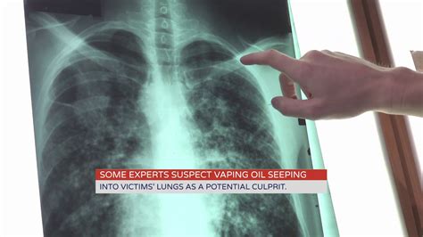 Vaping Warning From Cdc Youtube