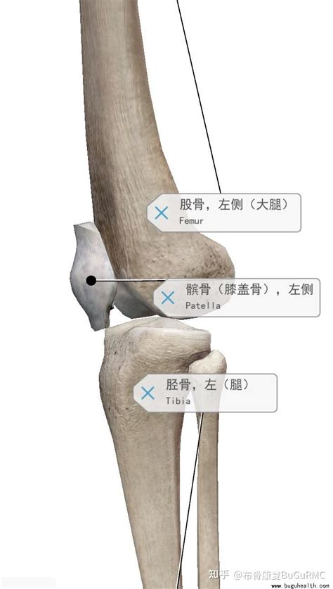 布骨医学科普带你了解髌骨脱位 知乎