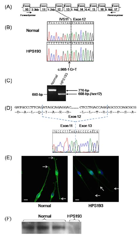 Molecular And Cellular Analysis Of Patient Hps193 Download Scientific