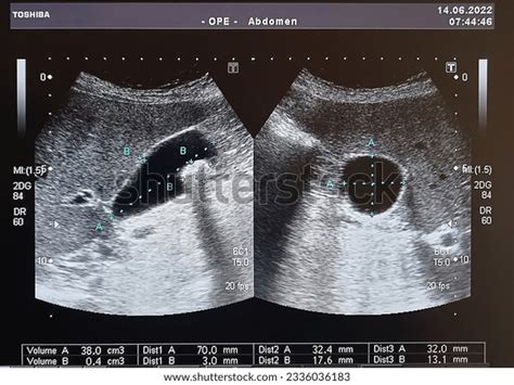 1056 Imágenes Fotos De Stock Objetos En 3d Y Vectores Sobre