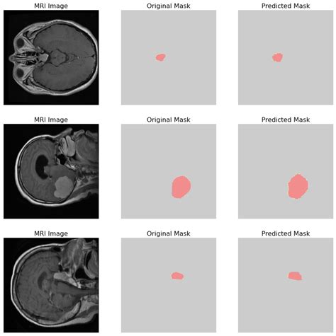 A Unified Pipeline For Simultaneous Brain Tumor Classification And Segmentation Using Fine Tuned