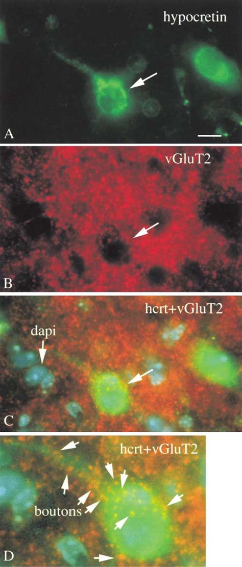Figure 7 From Hypocretinorexin Excites Hypocretin Neurons Via A Local