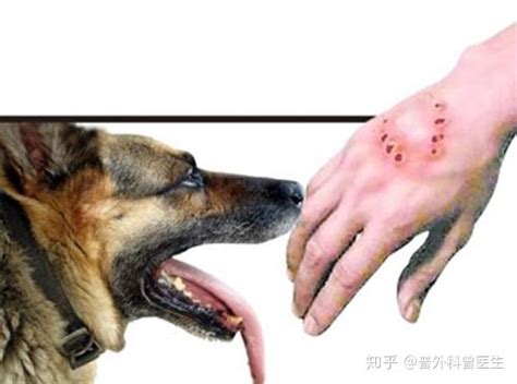 被猫和狗咬伤都需要接种狂犬疫苗吗？并不是的！有两种情况不需要 知乎