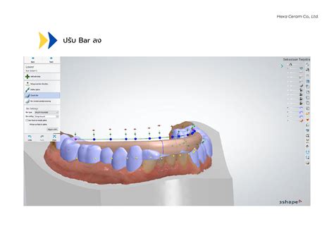 Ortho Stop ฟันล่าง Hexa Ceram Library หน้าหนังสือ 36 พลิก Pdf