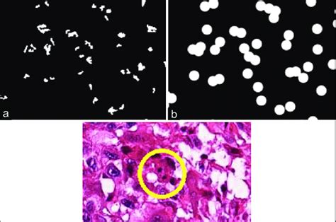 Result Of Deep Learning For Mitosis Detection Where The Blue Ratio Download Scientific Diagram
