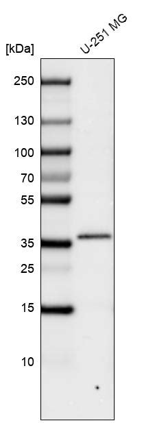 Anti Ctgf Monoclonal Atlas Antibody