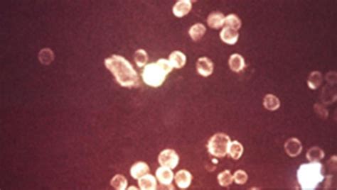 Who 37 Billion People Have Herpes Virus Fox 13 Tampa Bay
