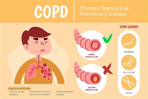 Chronic Obstructive Pulmonary Disease Copd Heathcote Street Surgery