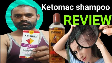 Best Anti Dandruff Shampoo Ketconazole Shampoo Best Shampoo For