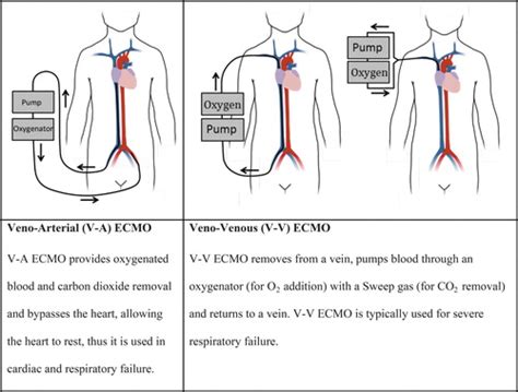 Ecmo Parts