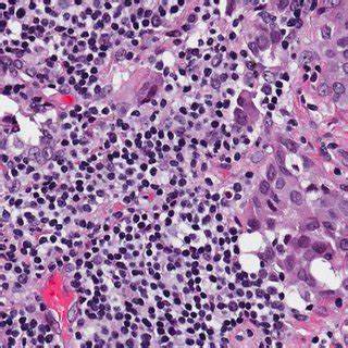 PDF SegDiff Image Segmentation With Diffusion Probabilistic Models