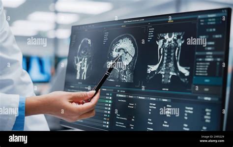 Medical Hospital Neurologist And Neurosurgeon Talk Use Computer Analyse Patient Mri Scan