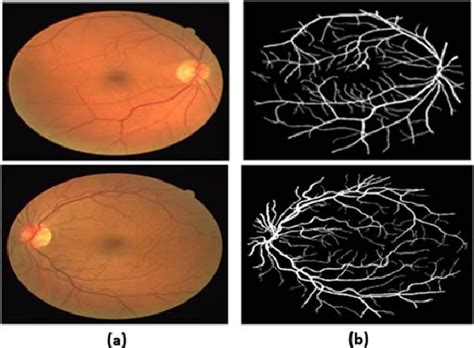 Representation Of The Fundus Image And Retinal Vessel Segmentation A