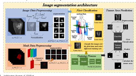 Figure 1 From An Attention Based Ai Assisted Segmentation System For Osteosarcoma Mri Images