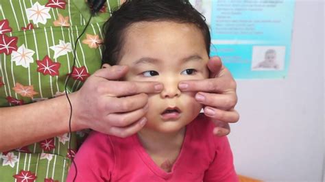 Зөвлөгөө Дархлаа сайжруулах цэгэн иллэг