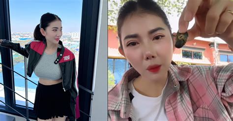 នារីម្នាក់ប្រាប់ពី បទពិសោធន៍ផ្ទាល់ ក្រោយកាត់ប្រម៉ាត់បាន ១ ឆ្នាំជាងហើយ