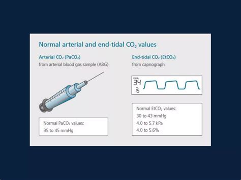 End Tidal Co2 And Transcutaneous Monitoring Pptx