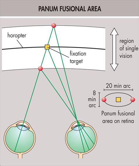 Sensory Status In Strabismus Clinical Tree