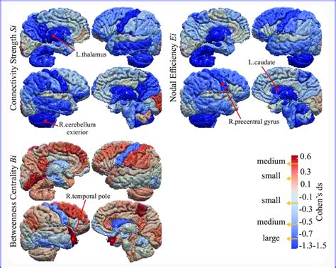 7 Maps Of The Effect Size Analysis Of The Difference Between Full Term Download Scientific