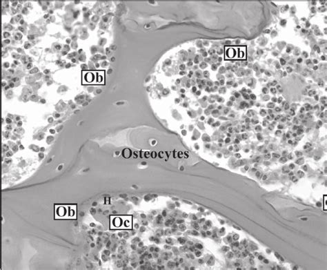 Decalcified Section 400x Magnification Showing The Bone Cells Download Scientific Diagram