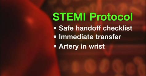 Health Beat Stemi Protocol Door To Balloon Saves Lives Health Beat