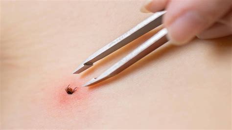 Kenelerin En Çok Isırdığı Kan Grubu Ortaya Çıktı O Kişiler Büyük Risk Altında