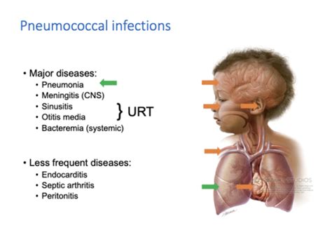 Lower Respiratory Tract Infections Flashcards Quizlet